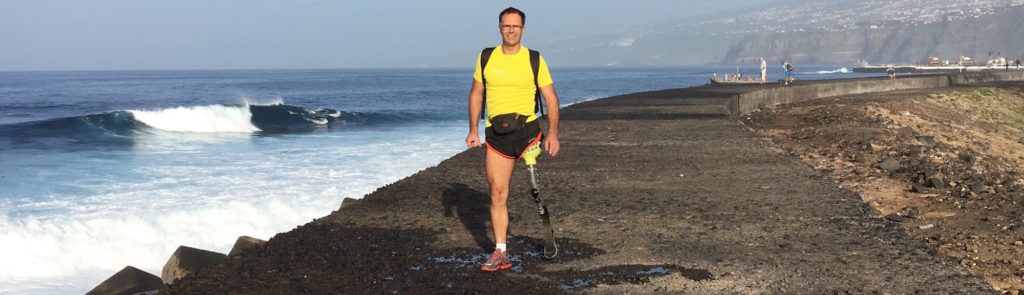 Prosthetic knee for short stump — Amputee Prosthetic Leg Tips